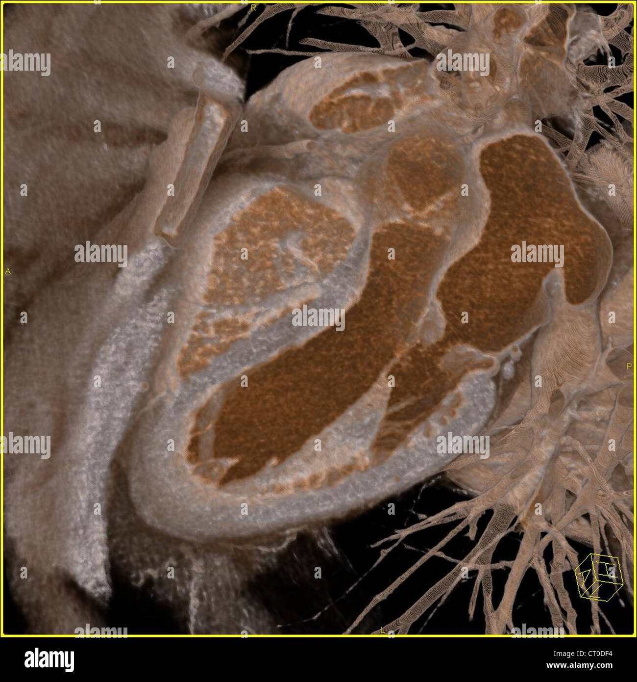 Heart valve scan hi-res stock photography and images - Alamy