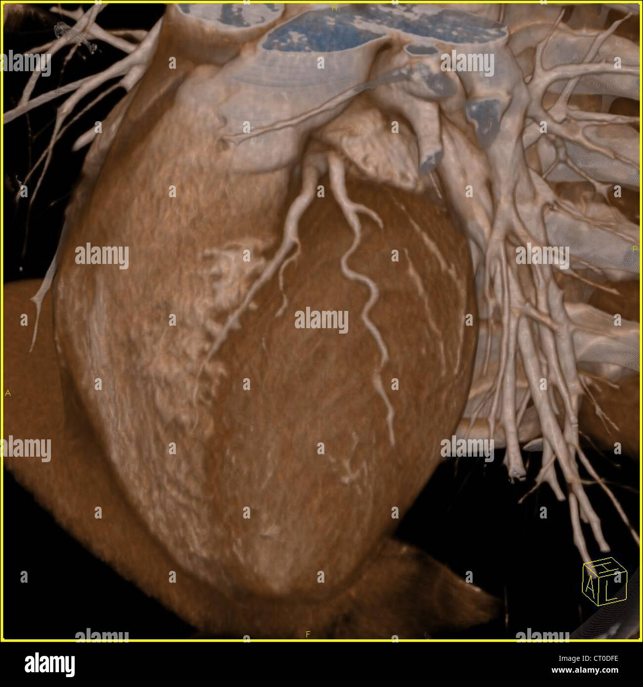 Heart blood vessels scan hi-res stock photography and images - Alamy