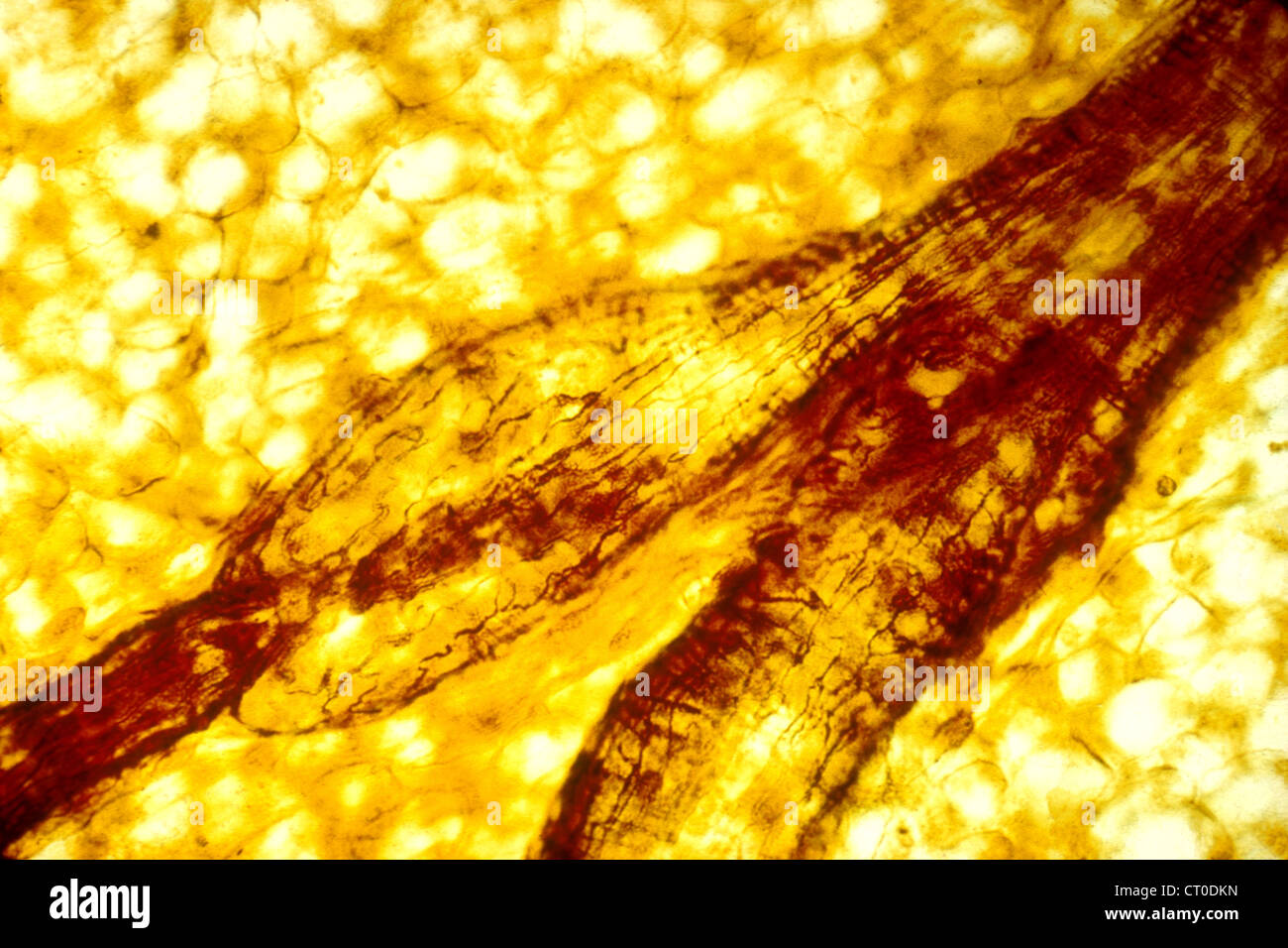 Lymphatic vessel microscope hi-res stock photography and images - Alamy