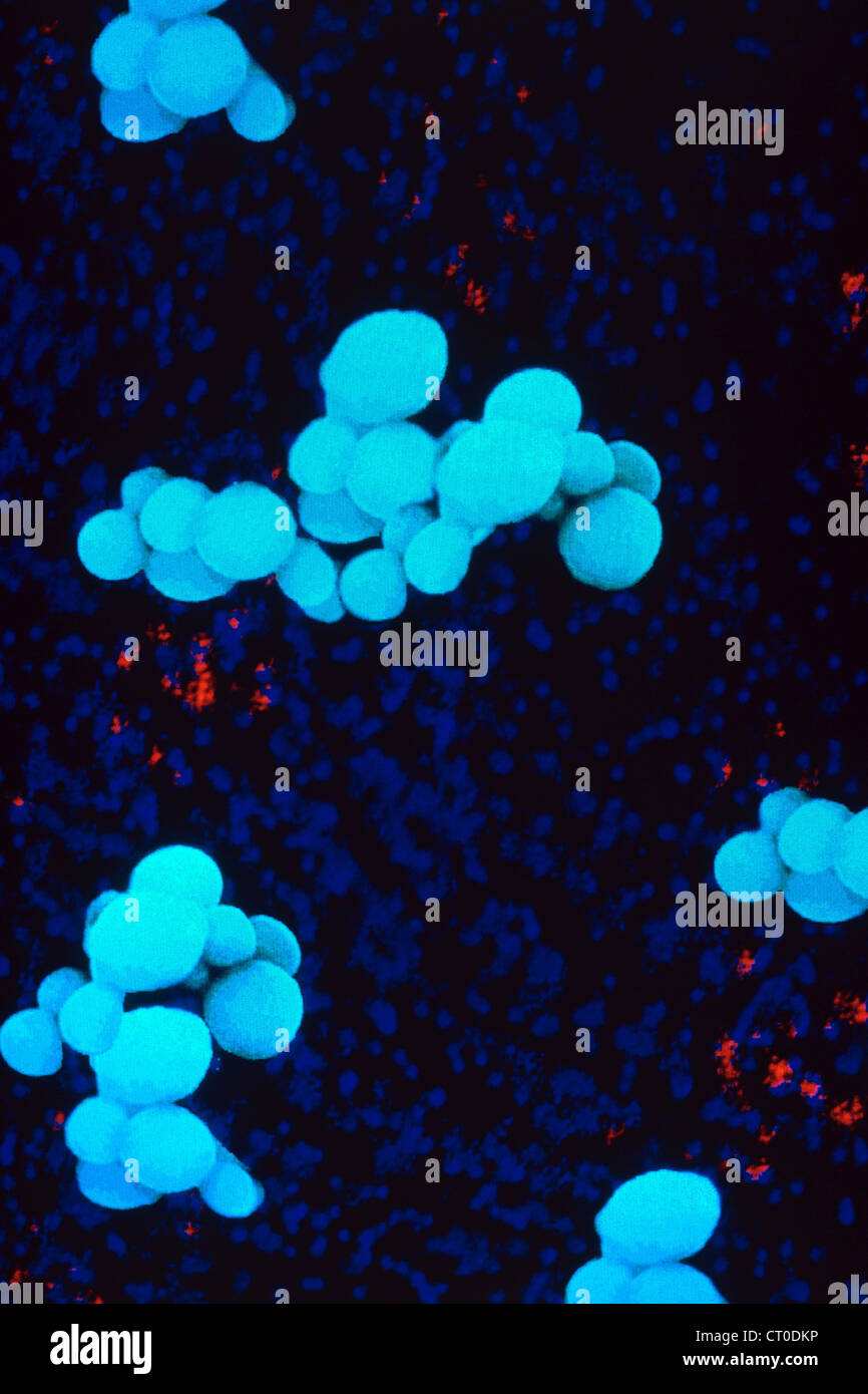 Candida albicans electron microscope hi-res stock photography and ...