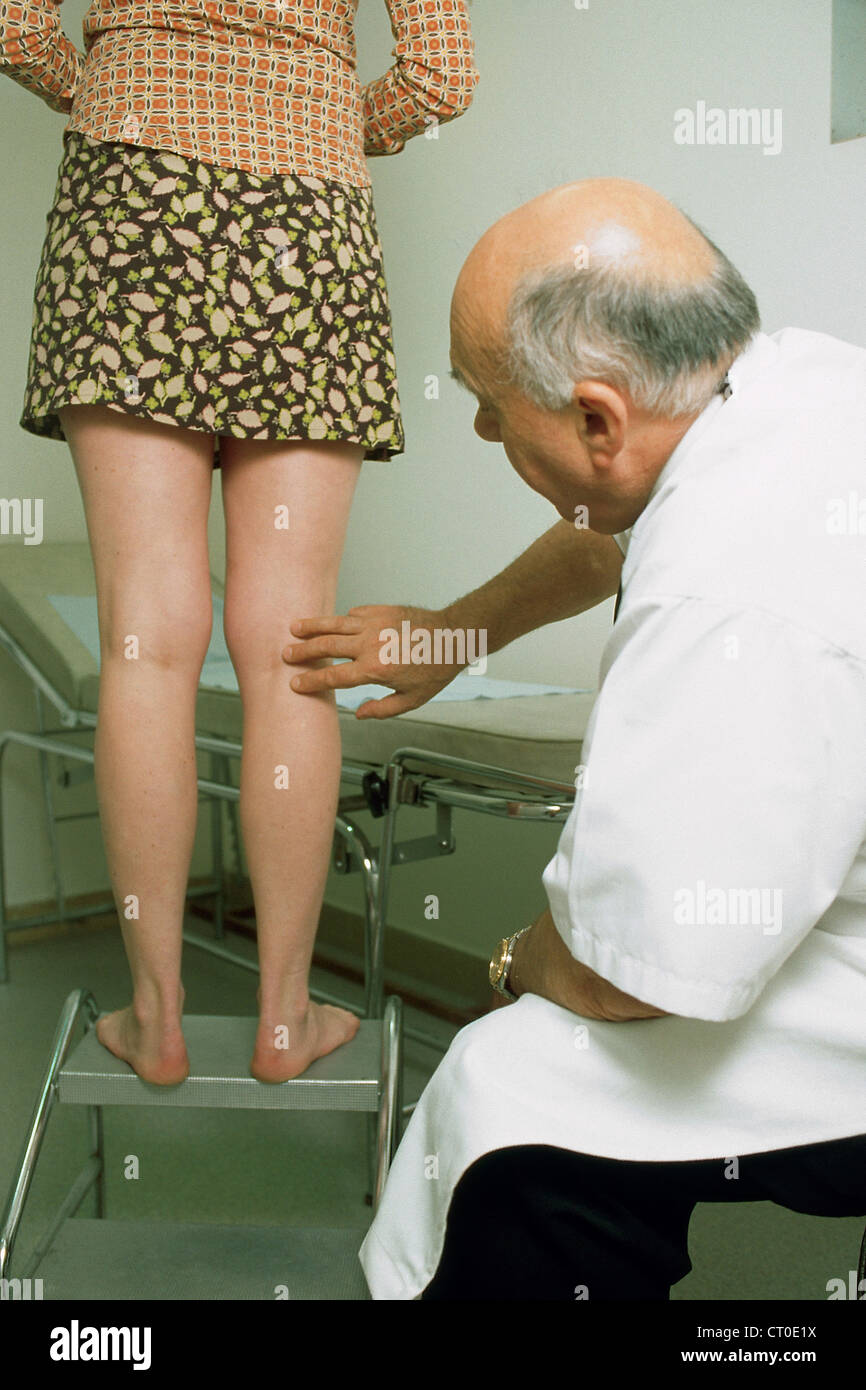 LEG, SYMPTOMATOLOGY IN A WOMAN Stock Photo - Alamy