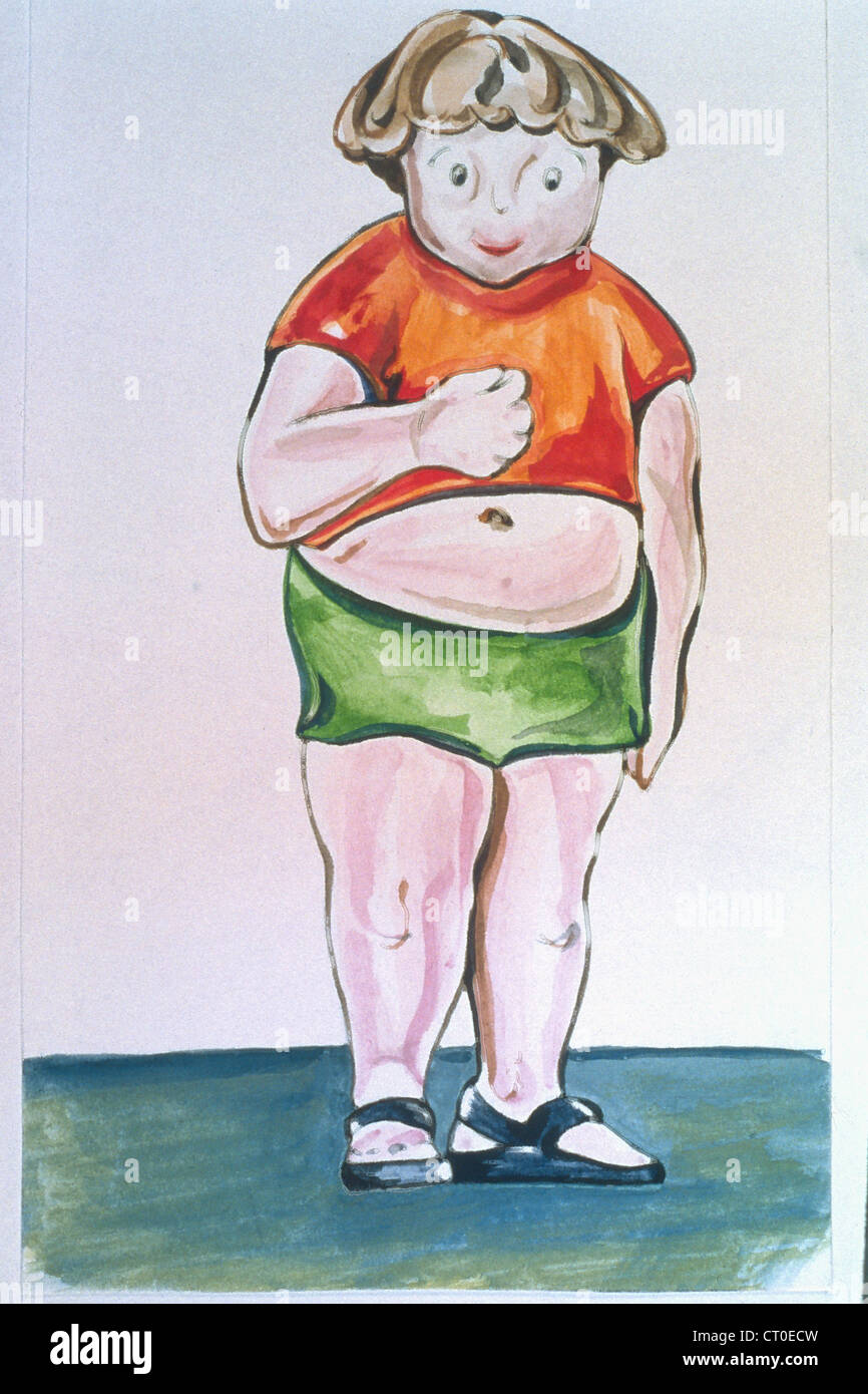 Childhood obesity illustration hi-res stock photography and images - Alamy