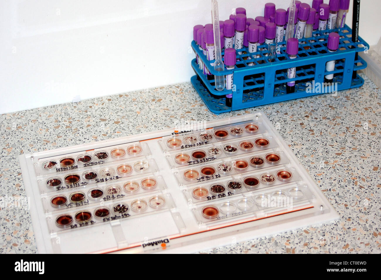 Rhesus blood types hi-res stock photography and images - Alamy