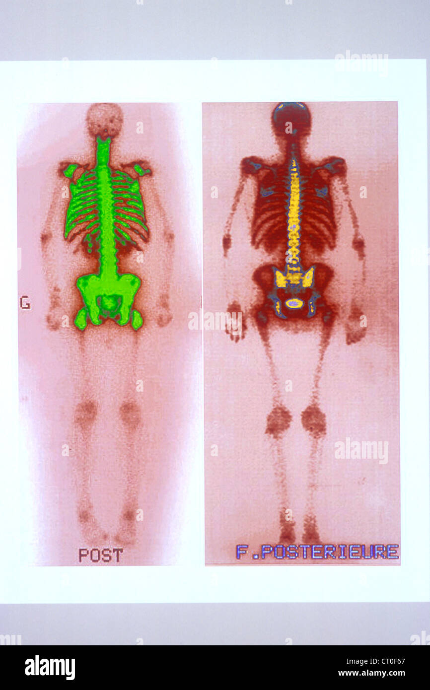 Scintiscanners hi-res stock photography and images - Alamy