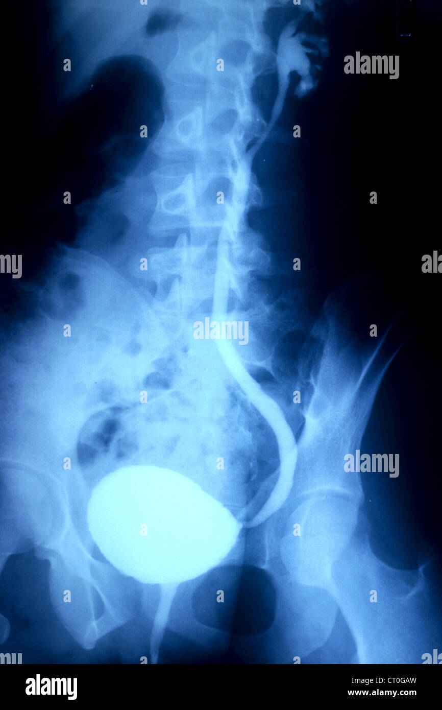 Vesico hi-res stock photography and images - Alamy