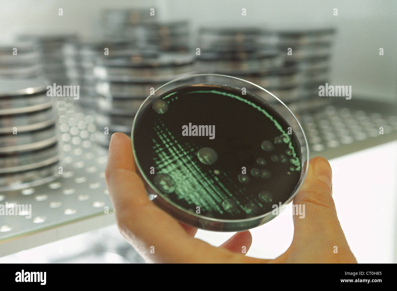 Legionella colonies hi-res stock photography and images - Alamy