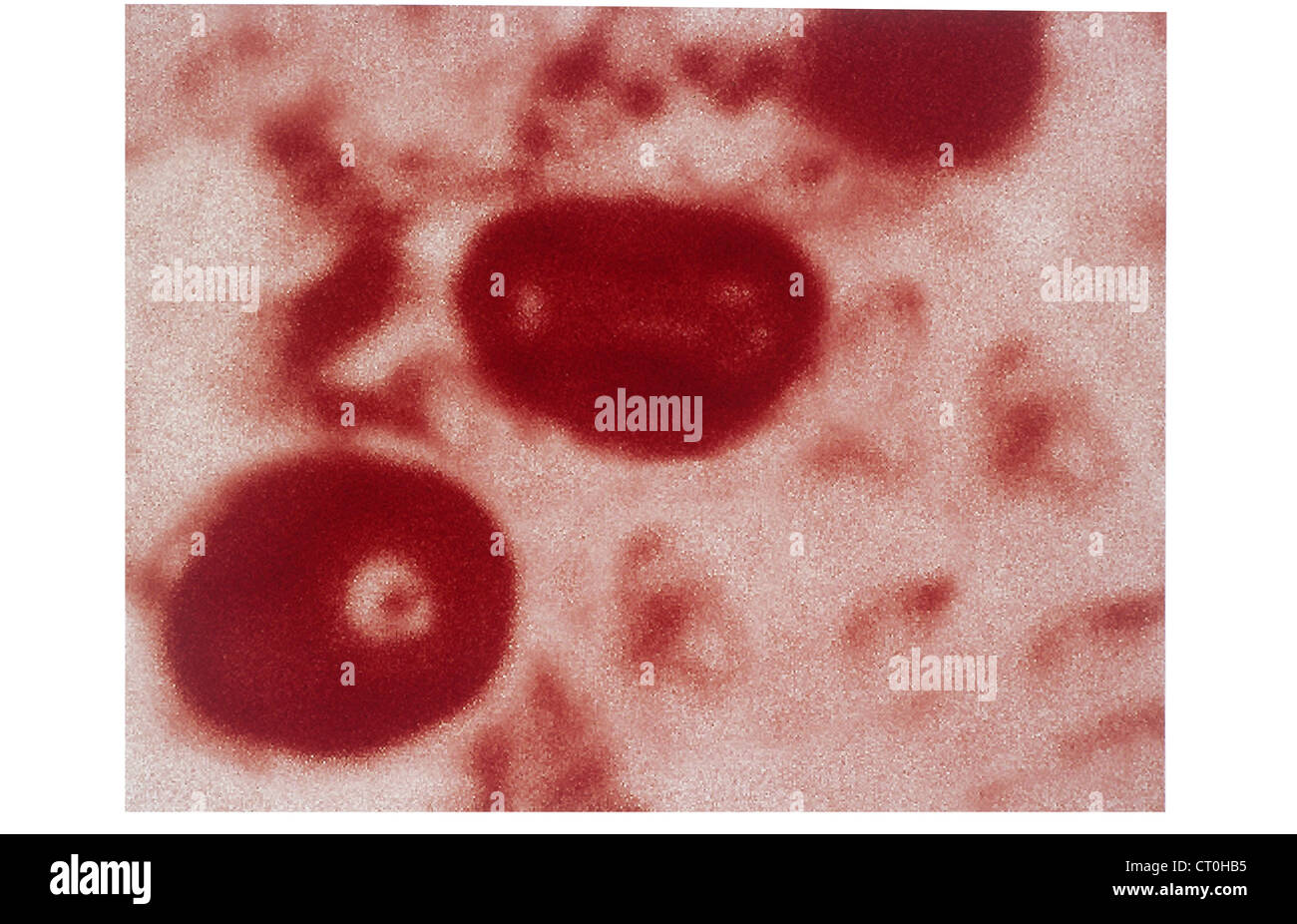 Smallpox virus microscope hi-res stock photography and images - Alamy