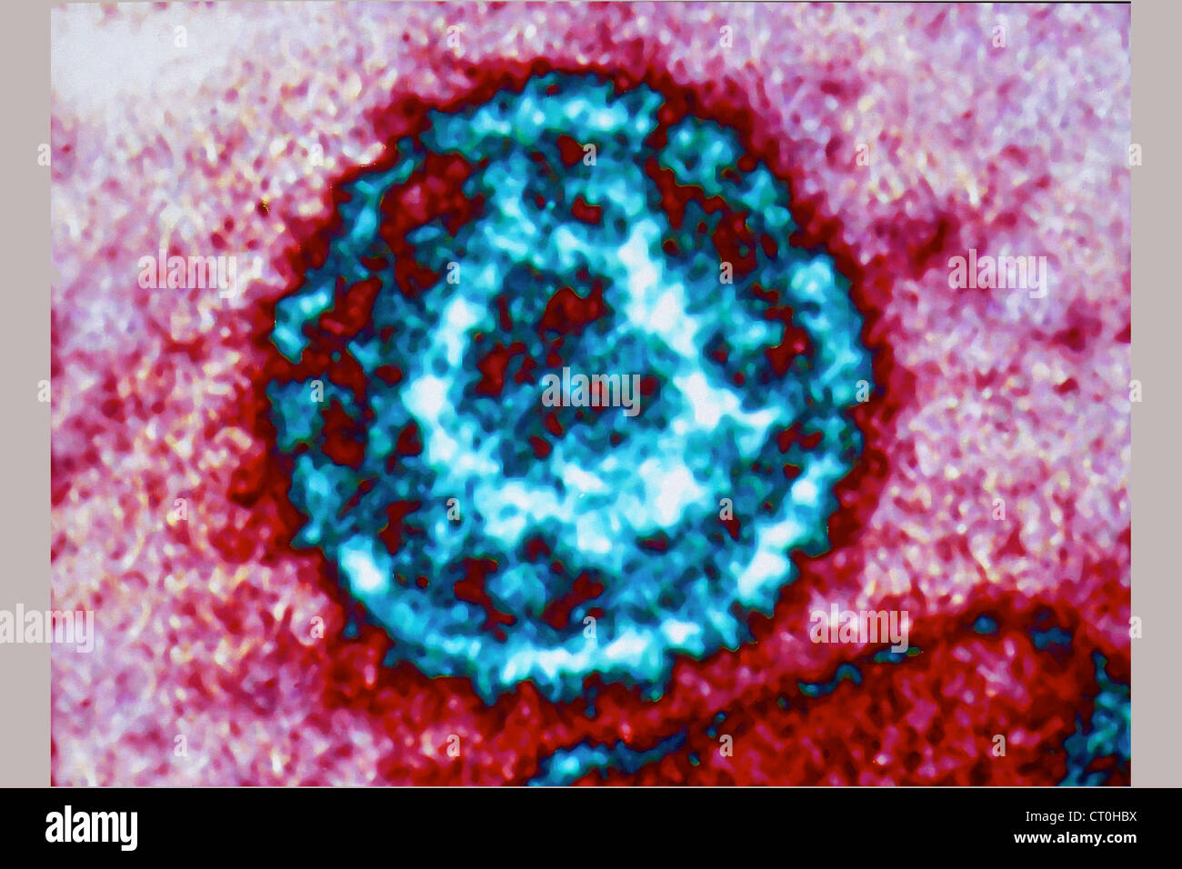 Glandular fever hi-res stock photography and images - Alamy