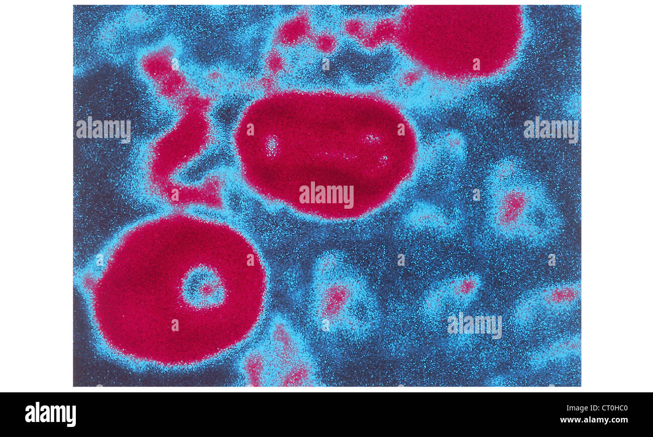 Smallpox virus microscope hi-res stock photography and images - Alamy