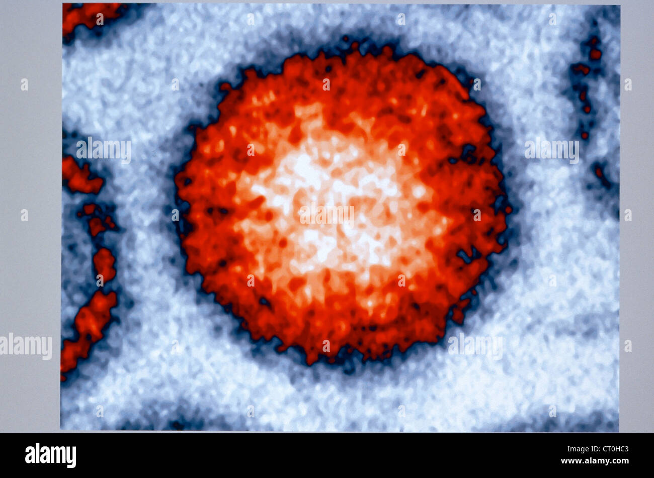 HERPES SIMPLEX VIRUS Stock Photo - Alamy