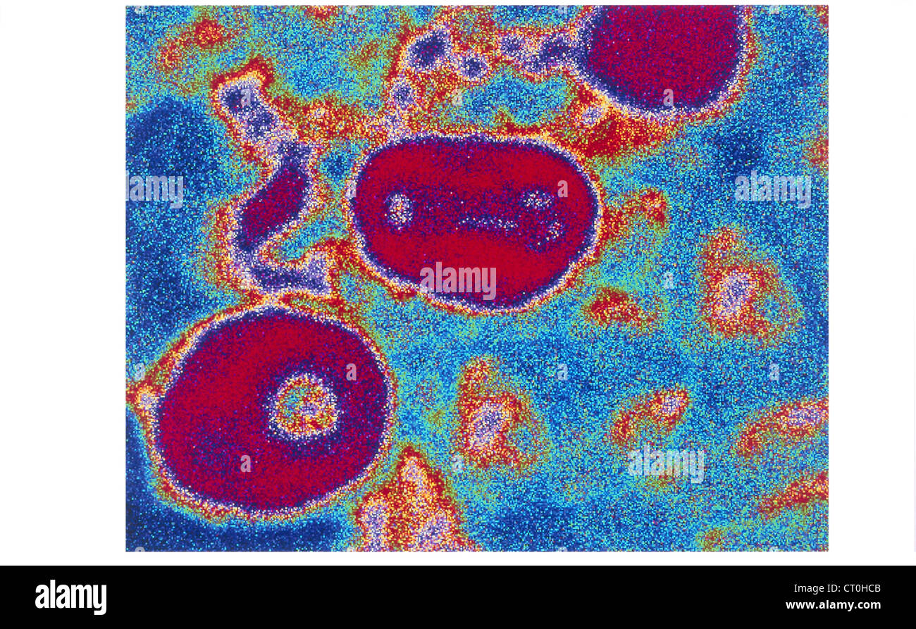 Smallpox virus microscope hi-res stock photography and images - Alamy