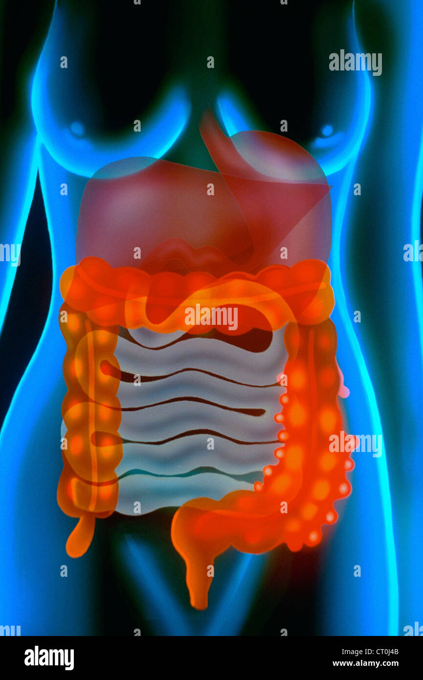 Vermiform Appendix Stock Photos & Vermiform Appendix Stock Images - Alamy