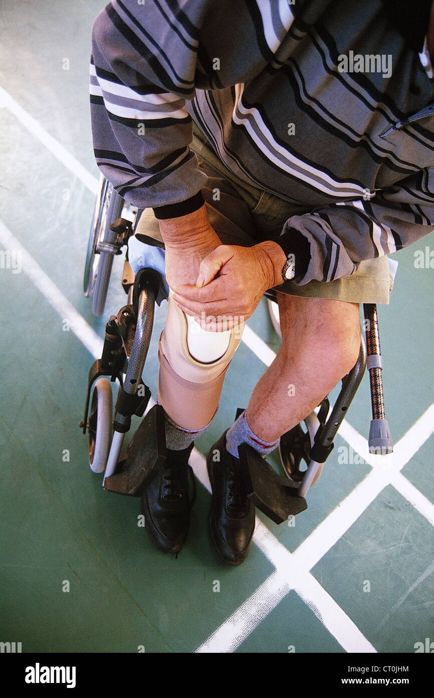 Ankle prosthesis hi-res stock photography and images - Alamy