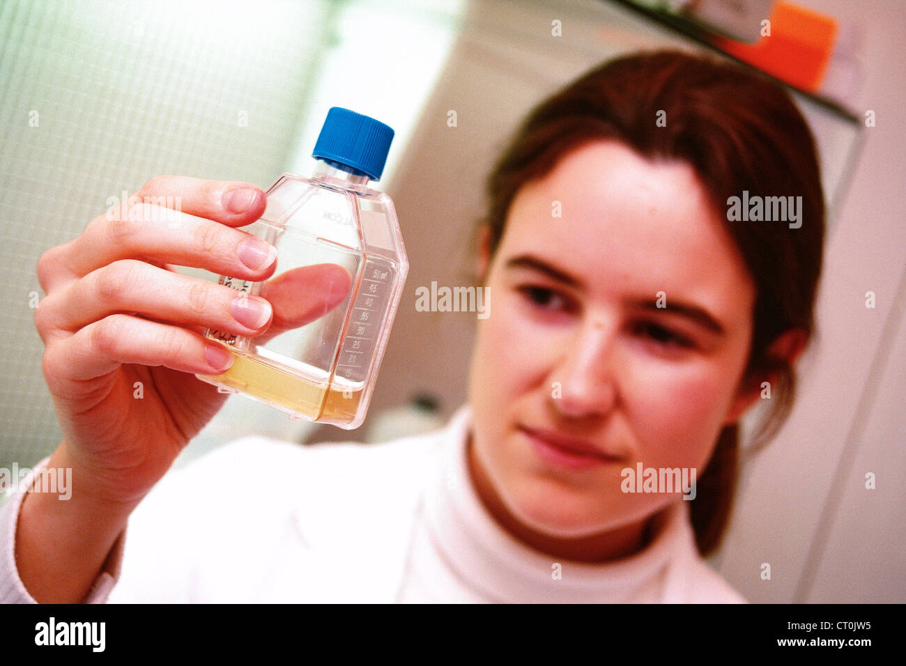 Down syndrome hospital woman hi-res stock photography and images - Alamy