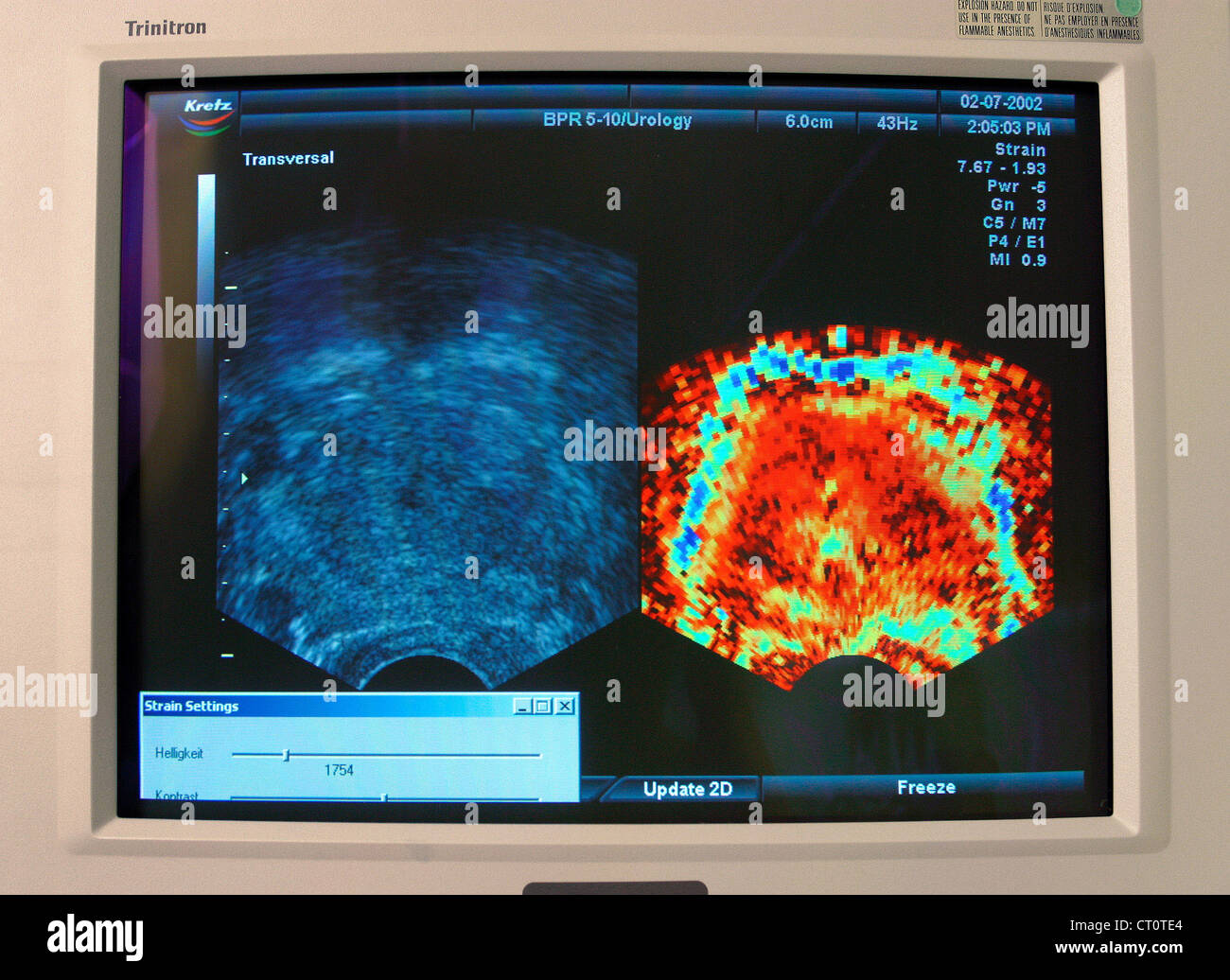 Prostate Examination Stock Photos & Prostate Examination Stock Images ...