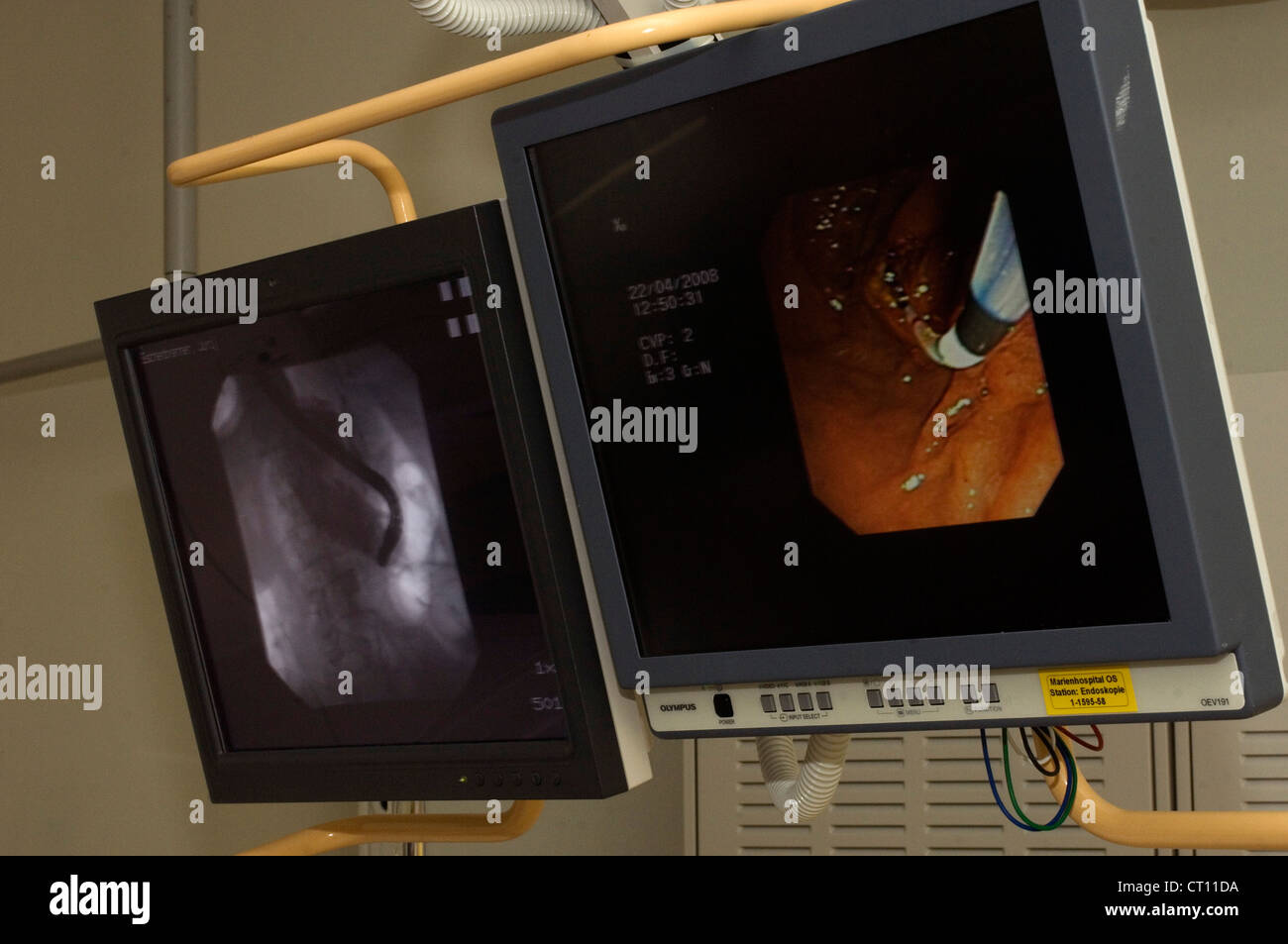Endoscopic procedure monitoring screens Stock Photo - Alamy