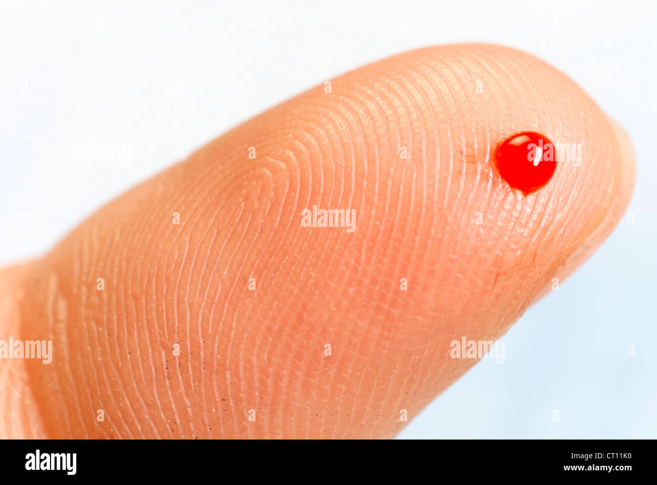 Testing skin lesions hi-res stock photography and images - Alamy