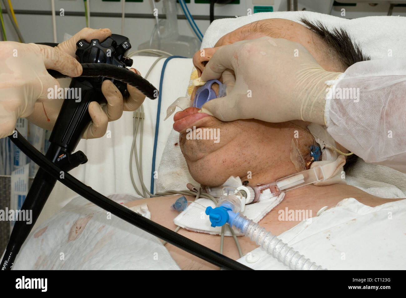Endoscopy Procedure