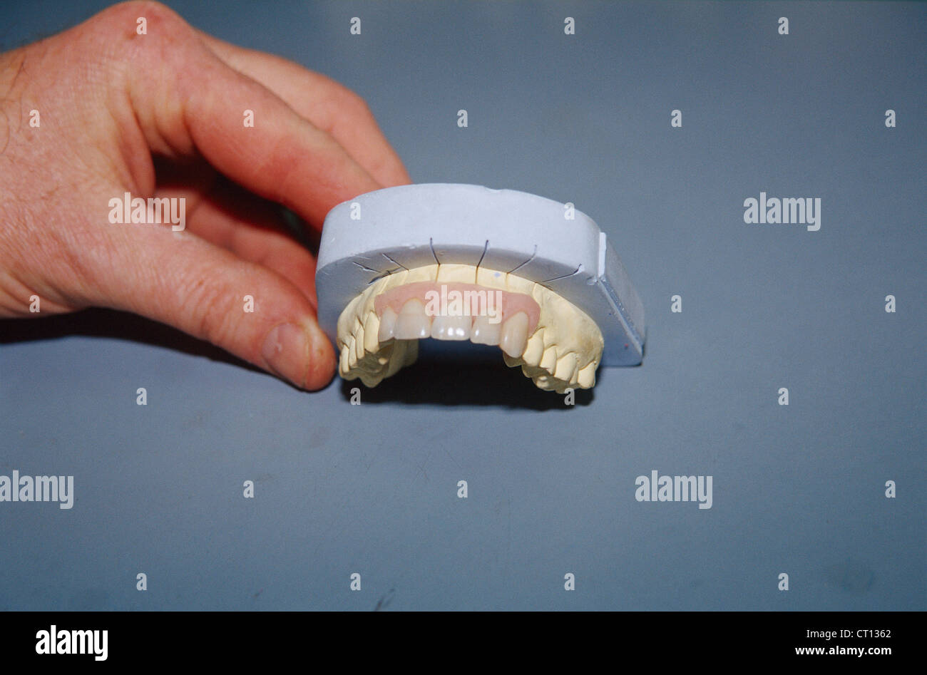 Metallic prosthesis hi-res stock photography and images - Alamy