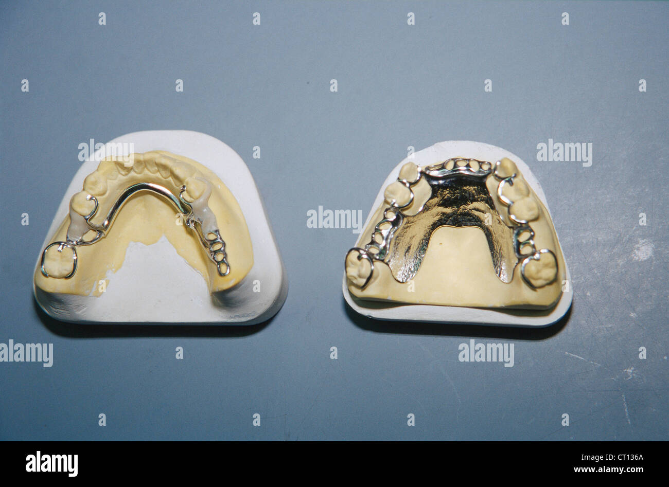 Dental prosthesis materials hi-res stock photography and images - Alamy
