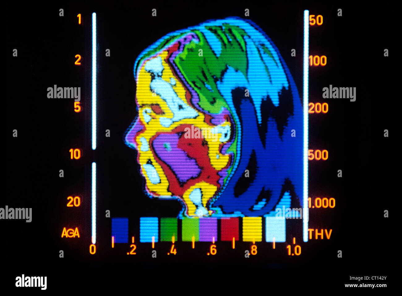 Thermography hi-res stock photography and images - Alamy