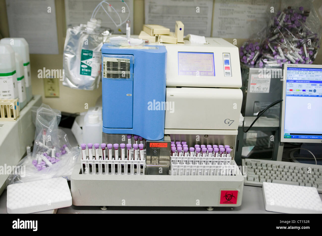 Blood samples ready for analysis Stock Photo - Alamy