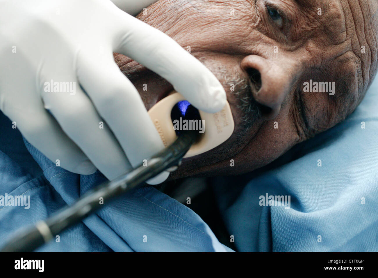 Old man undergoes an endoscopy Stock Photo - Alamy