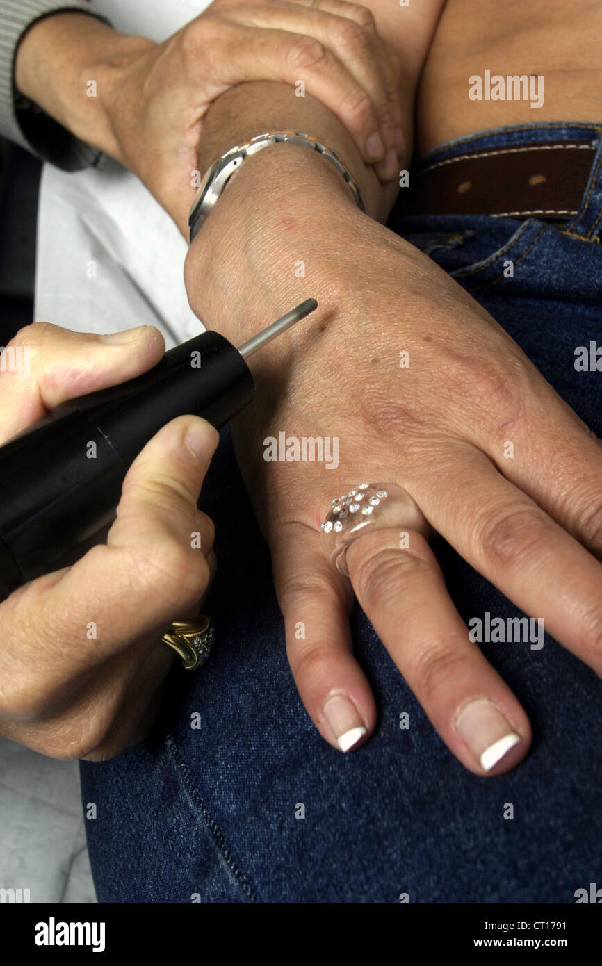 Cafe au lait skin pigmentation hi-res stock photography and images - Alamy