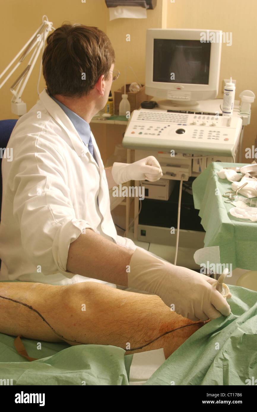 Venous doppler test hi-res stock photography and images - Alamy