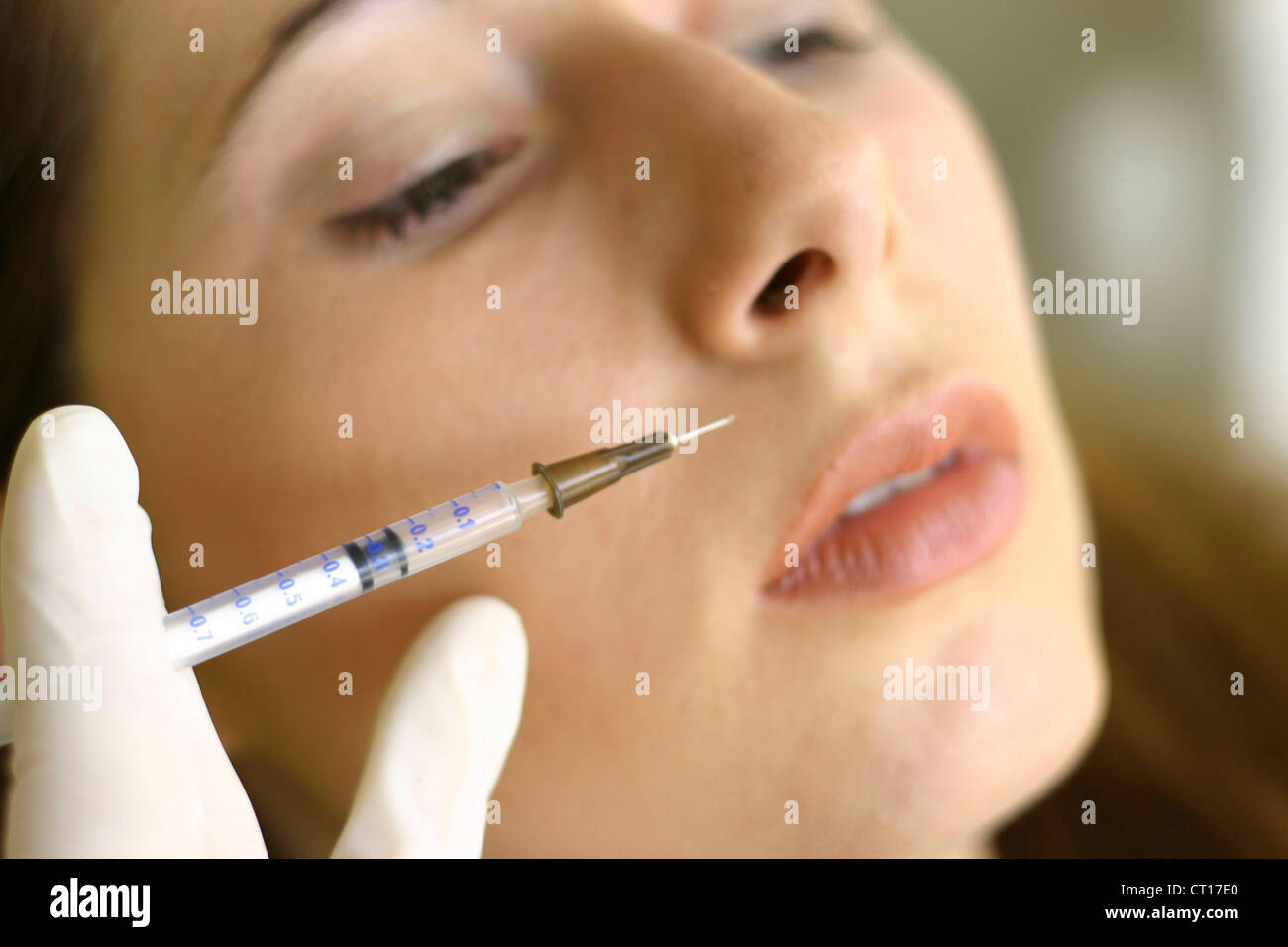 BOTOX TREATMENT, WOMAN Stock Photo - Alamy