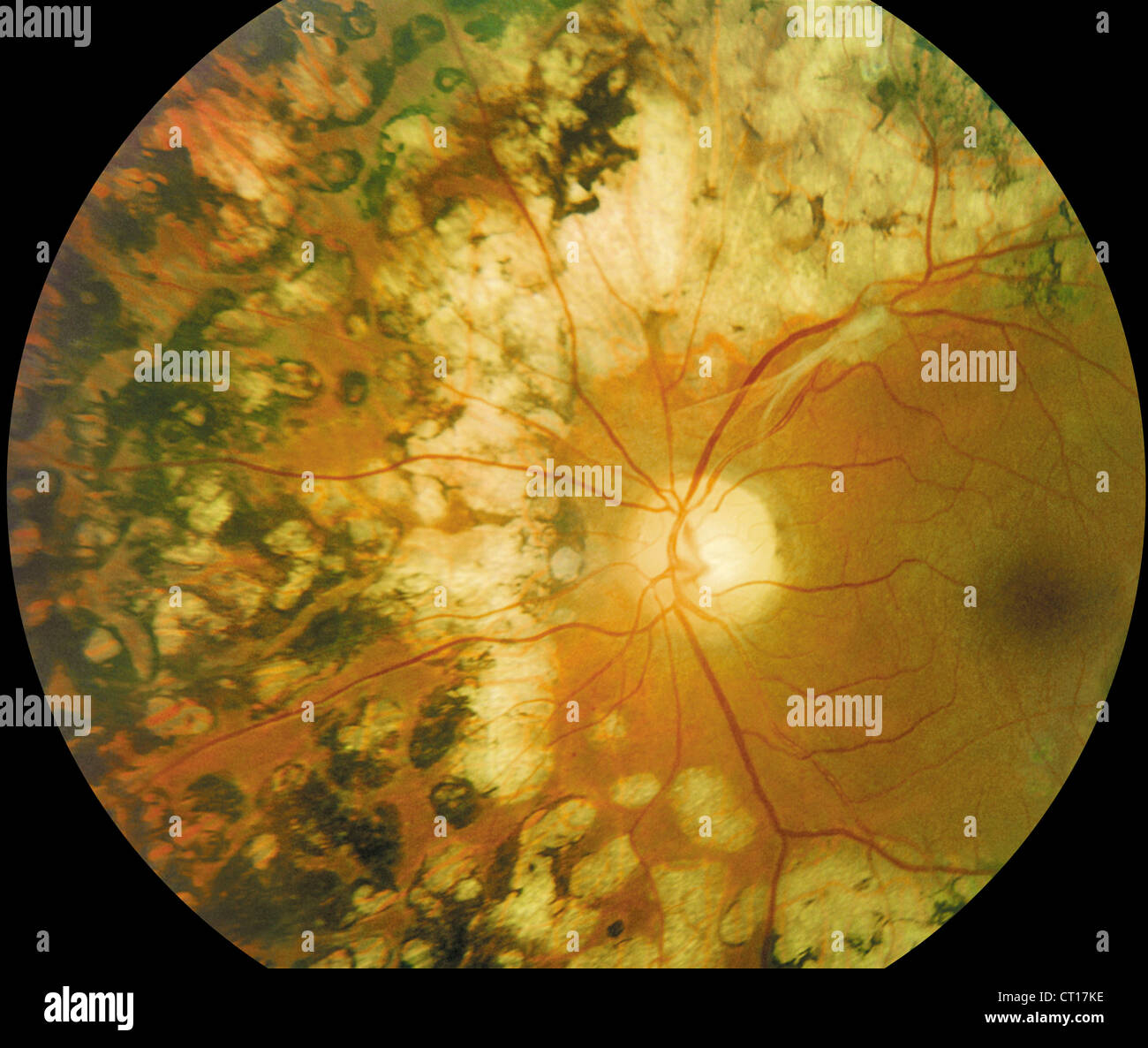 Retinography hi-res stock photography and images - Alamy