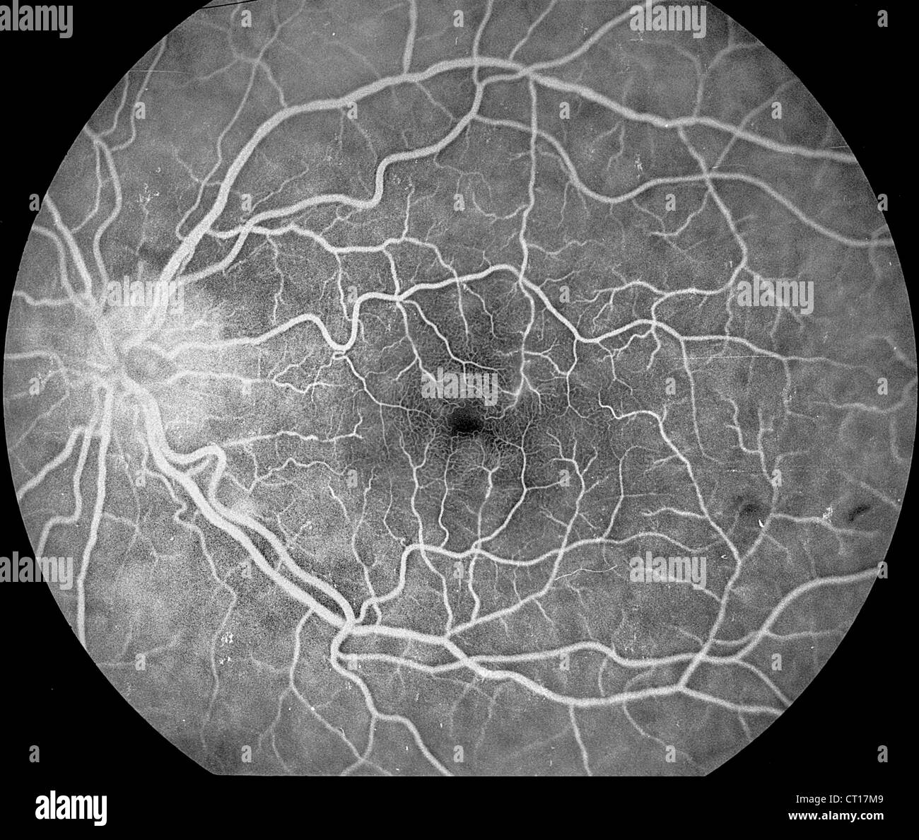 Normal eye exam hi-res stock photography and images - Alamy