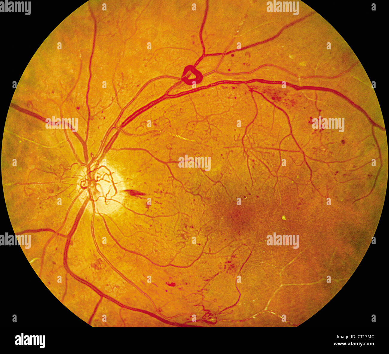 Retinography hi-res stock photography and images - Alamy