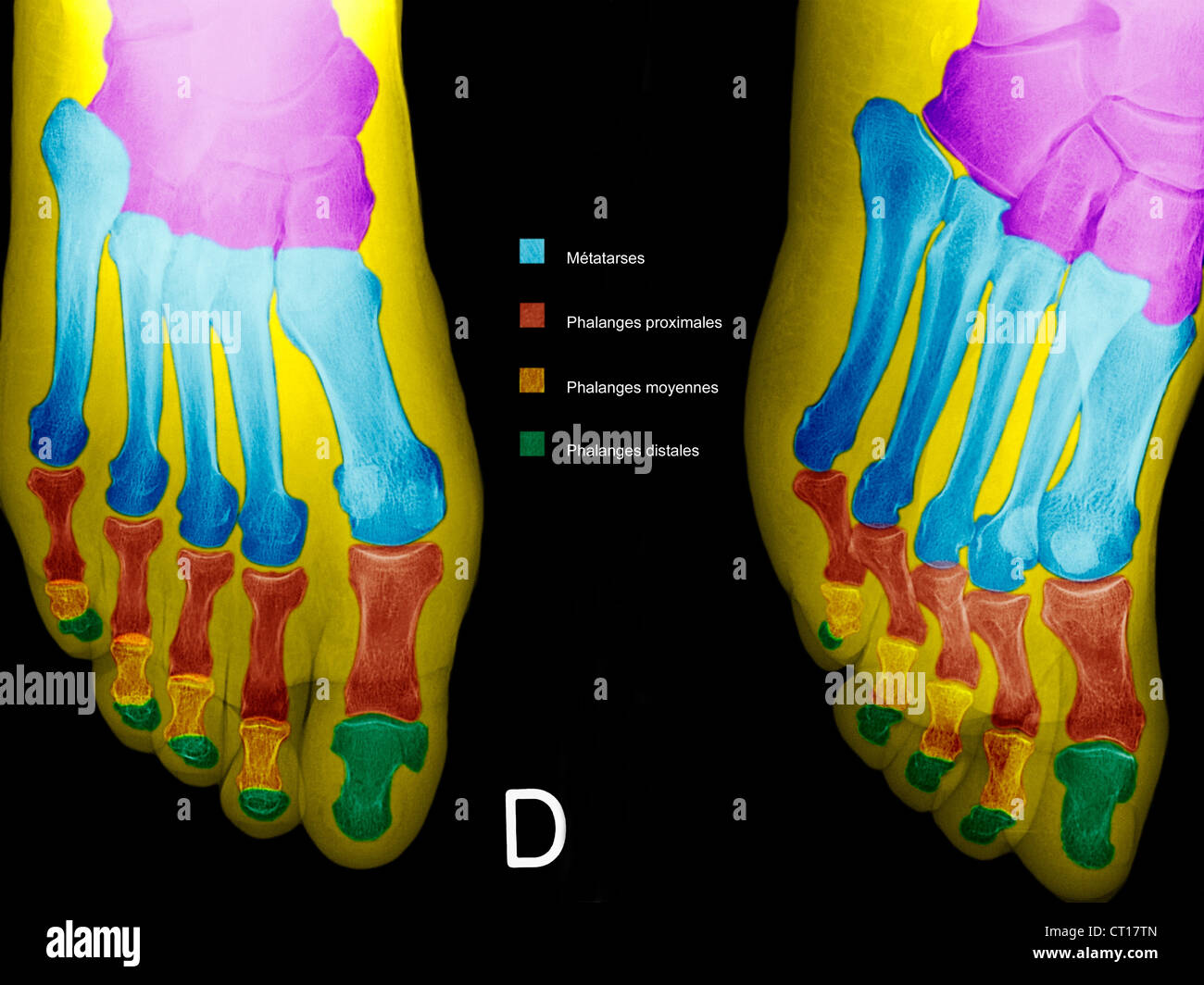 Distal phalanges foot bones hi-res stock photography and images - Alamy