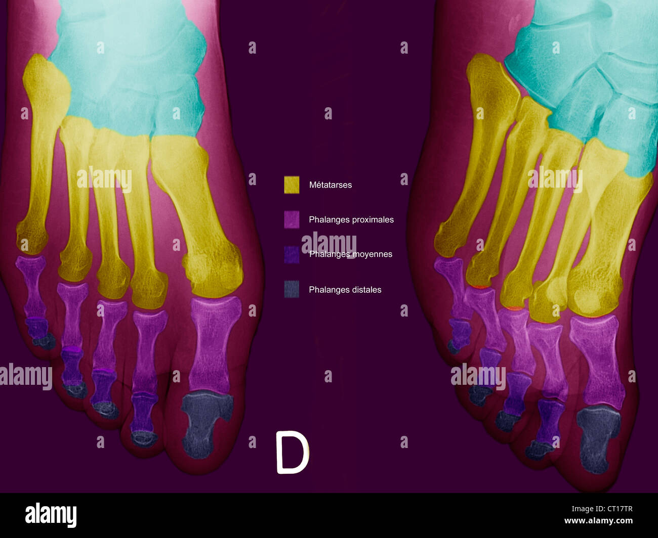 Second phalanx hi-res stock photography and images - Alamy