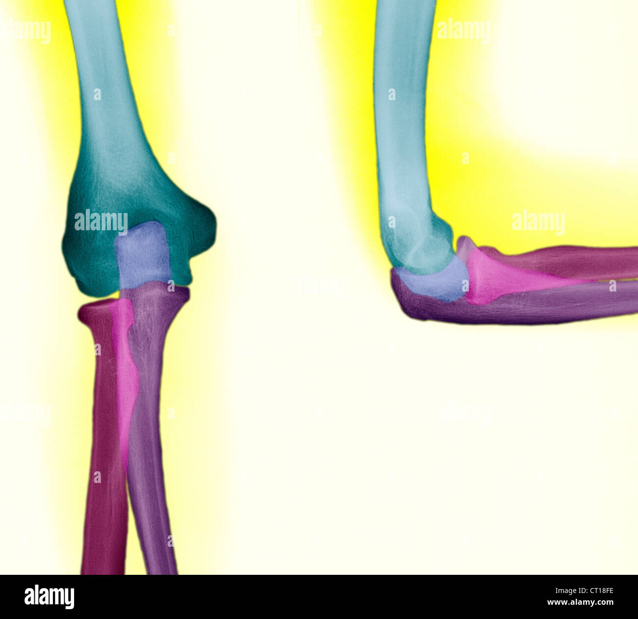 Cubiti hi-res stock photography and images - Alamy