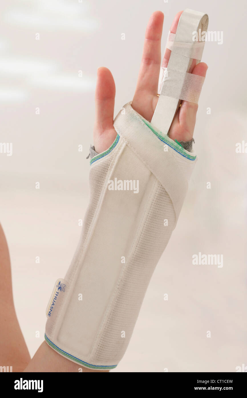 Arm splint hi-res stock photography and images - Alamy