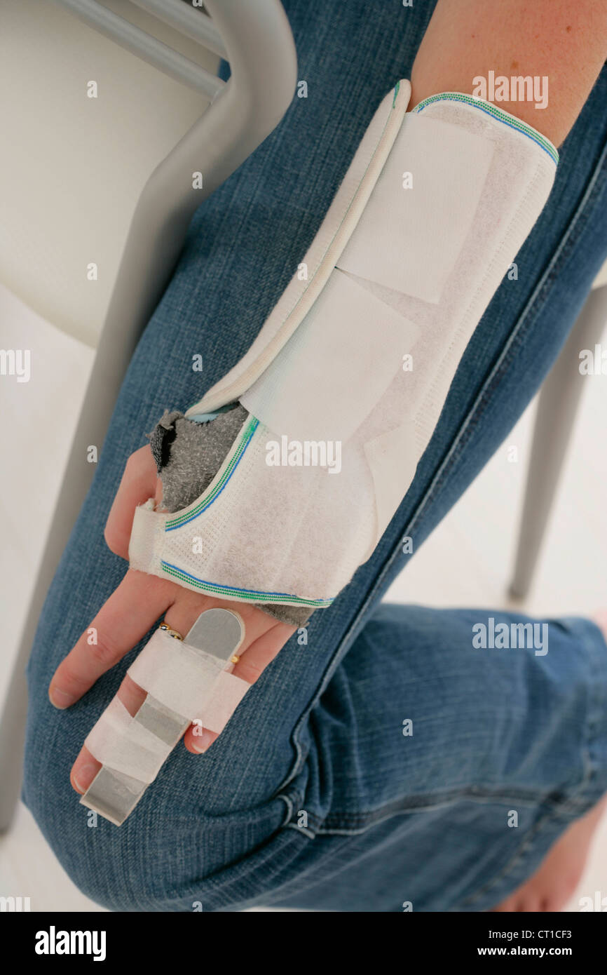 Orthopedic splints hi-res stock photography and images - Alamy