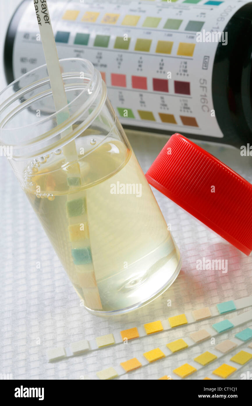 URINE TEST STRIP Stock Photo - Alamy