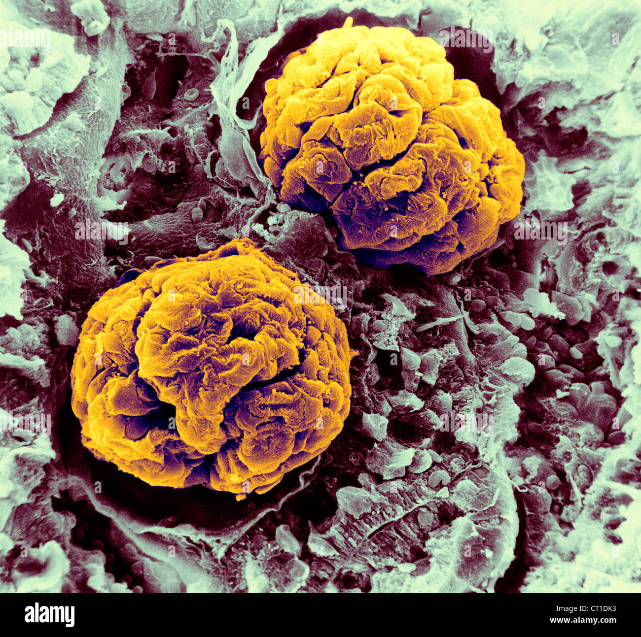 Glomerulus sem hi-res stock photography and images - Alamy