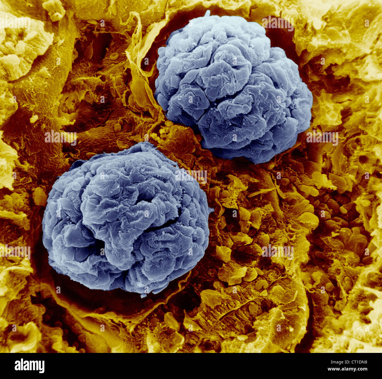 Glomerulus High Resolution Stock Photography and Images - Alamy