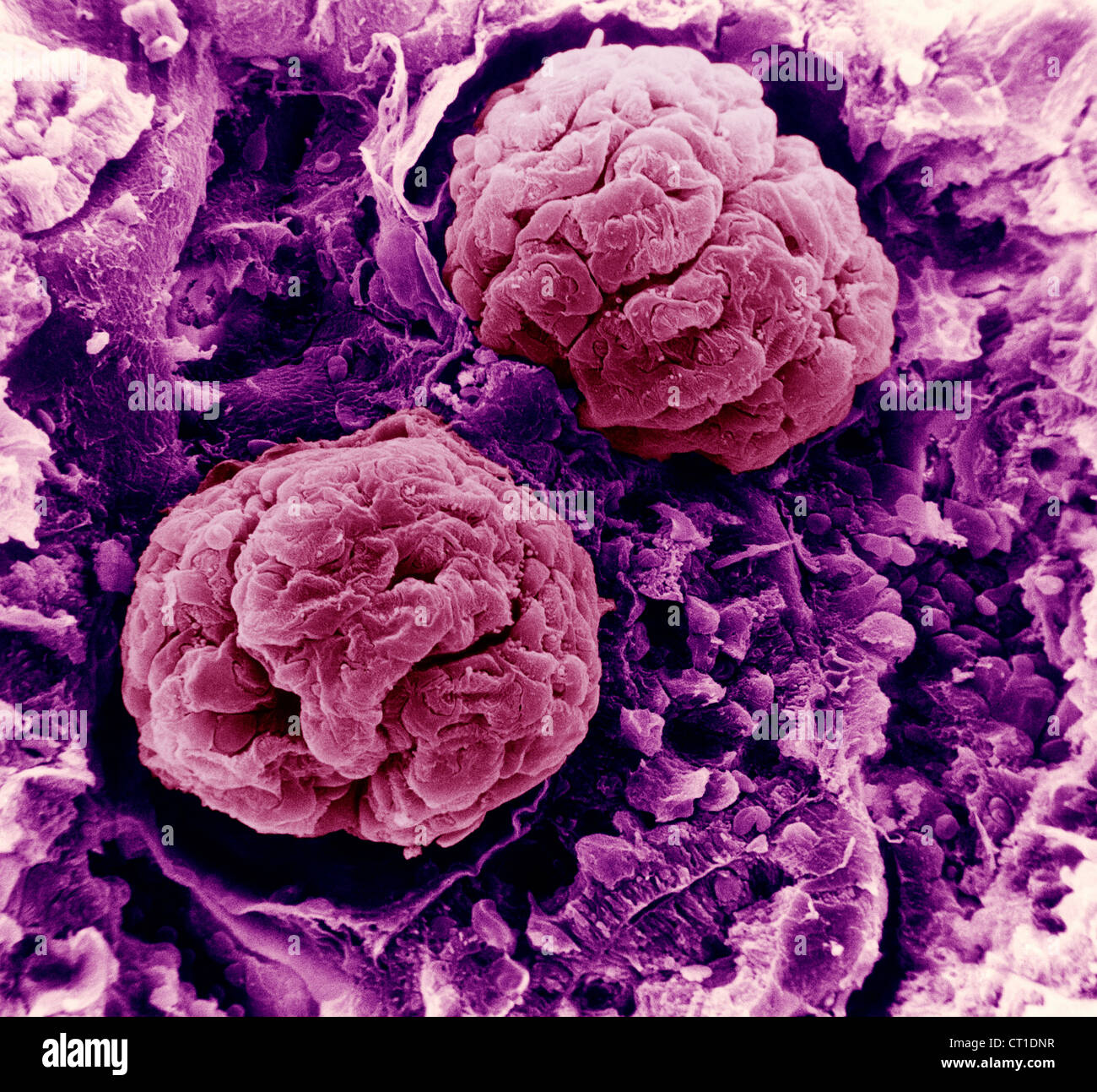 Glomerulus sem hi-res stock photography and images - Alamy