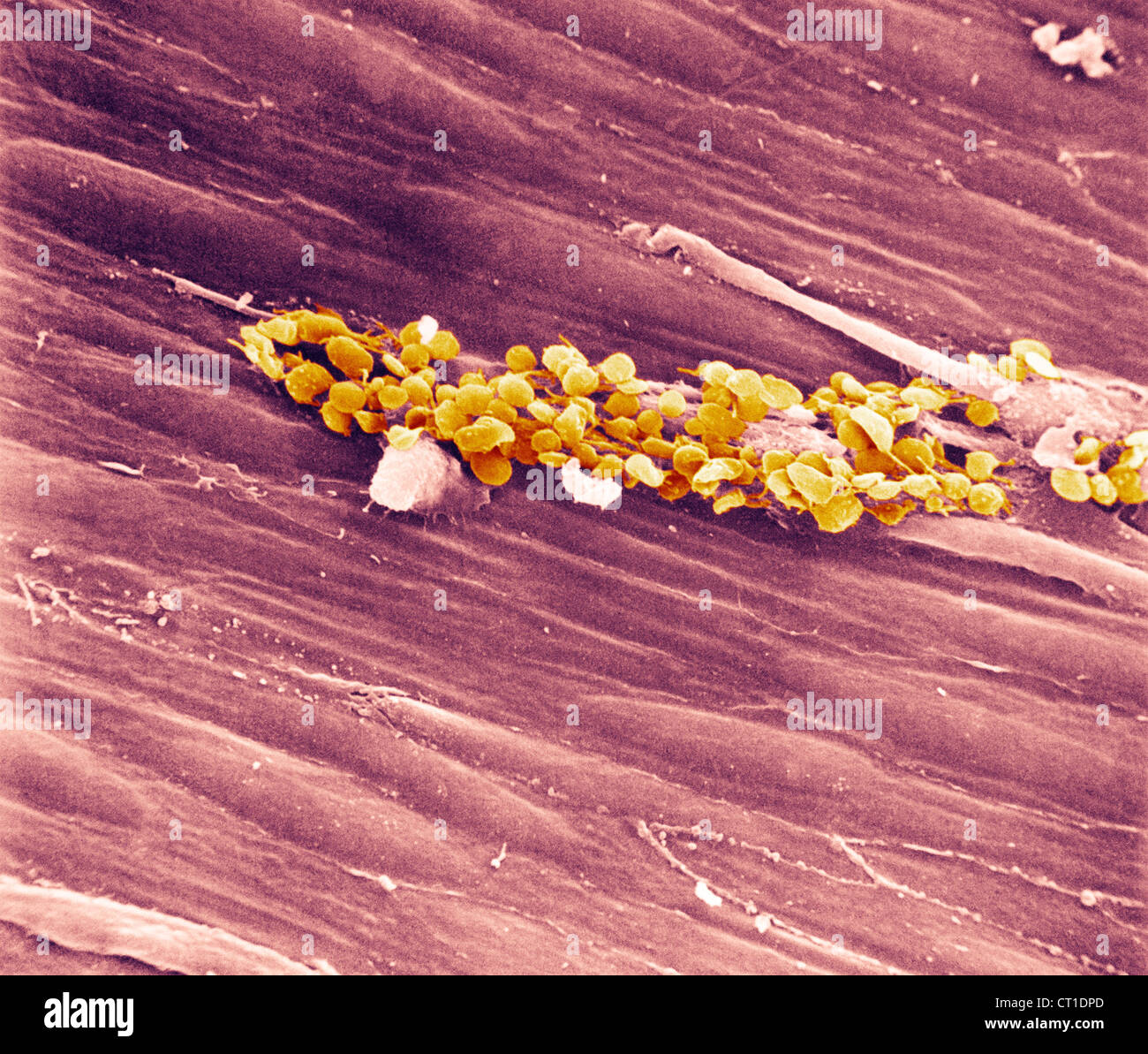 RABBIT PLATELET, SEM Stock Photo - Alamy