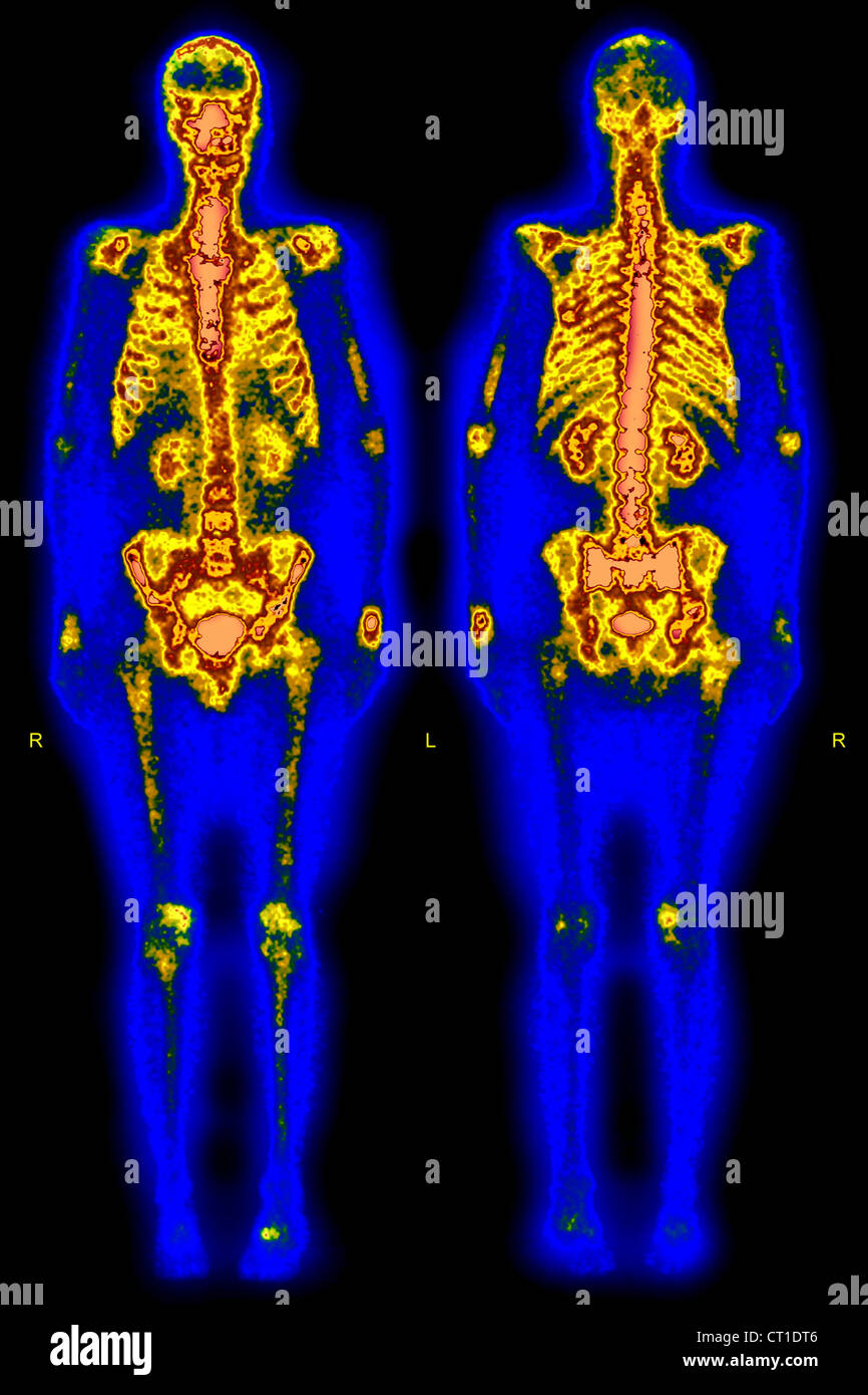 Whole body scanner hi-res stock photography and images - Alamy