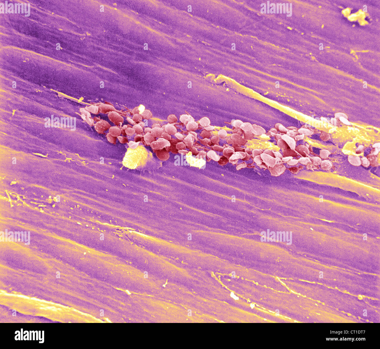 RABBIT PLATELET, SEM Stock Photo - Alamy