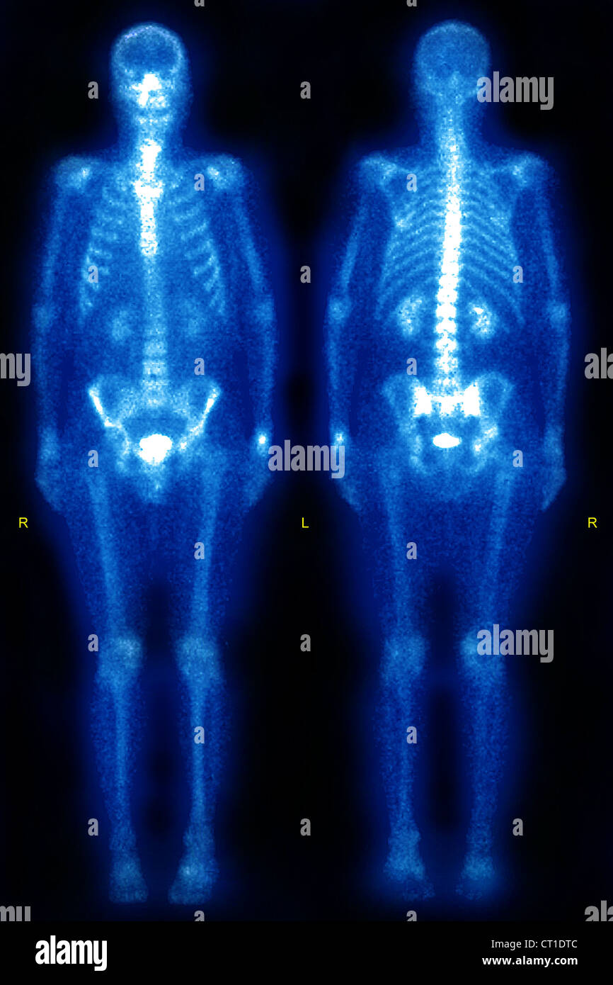 Whole body scanner hi-res stock photography and images - Alamy