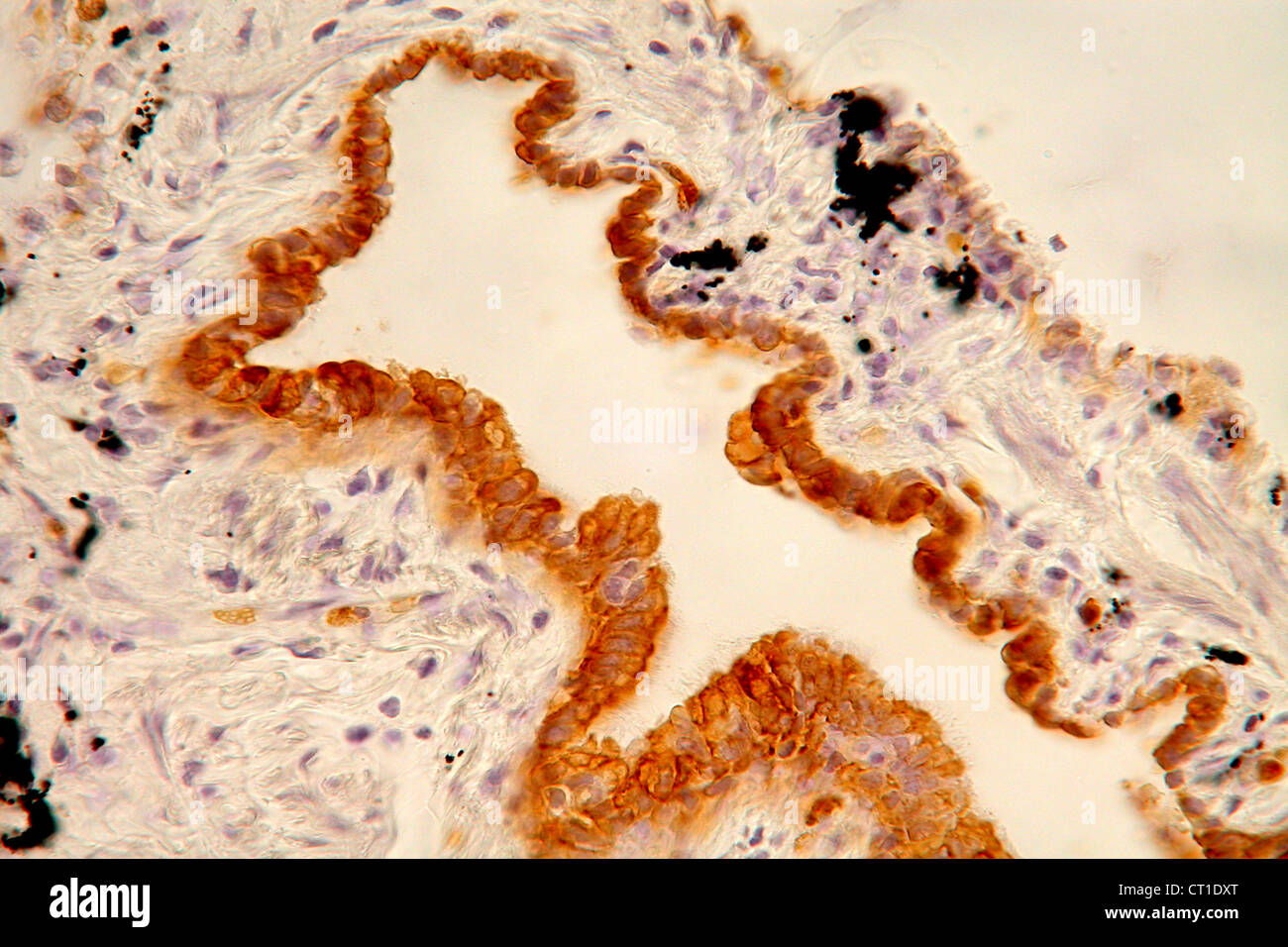 Histology bronchus hi-res stock photography and images - Alamy