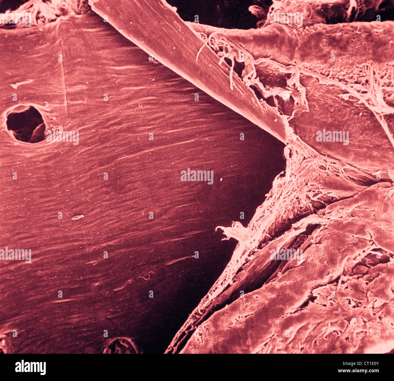 BLOOD CAPILLARY, SEM Stock Photo - Alamy