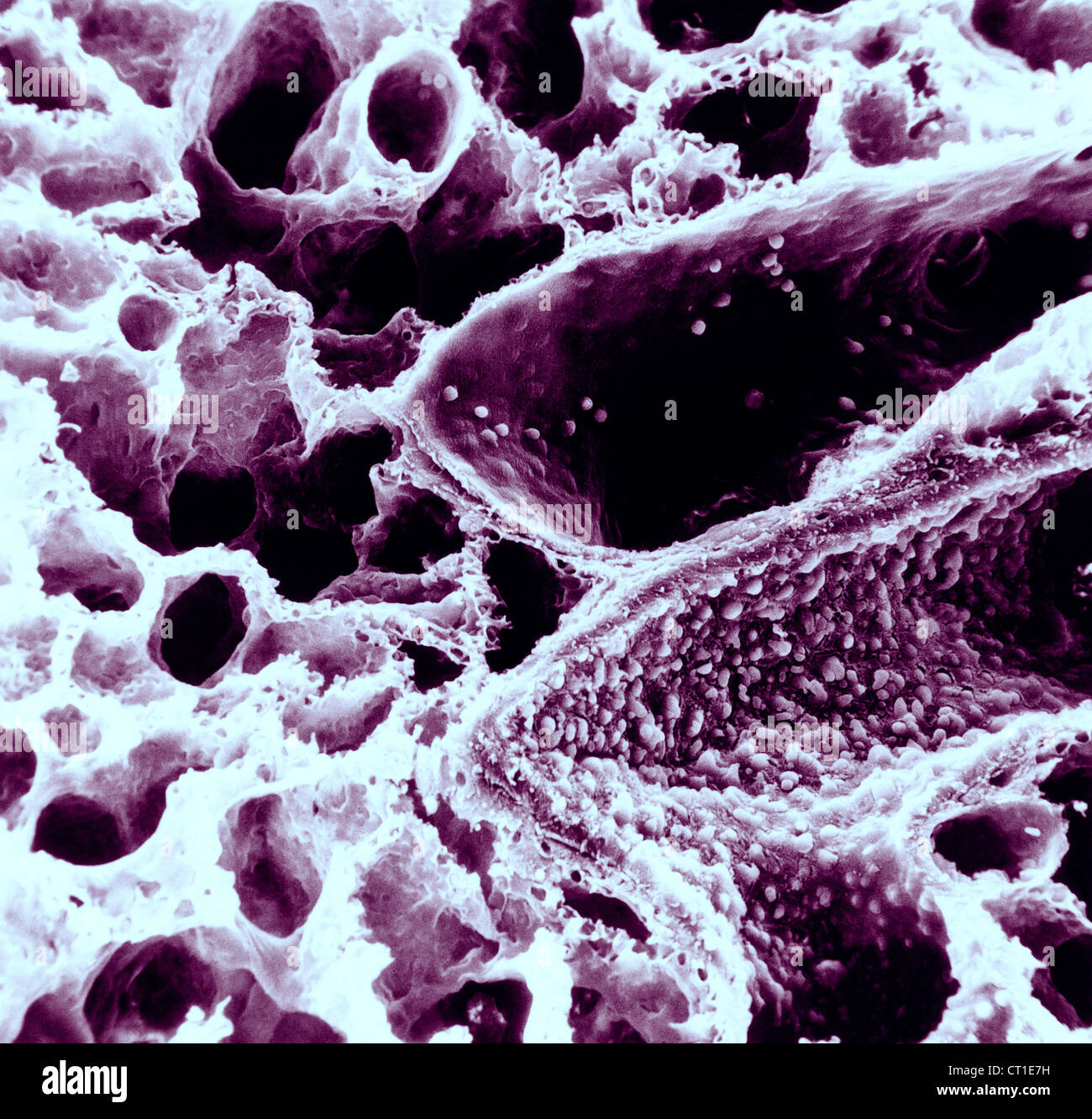 Lung alveolus micrograph hi-res stock photography and images - Alamy