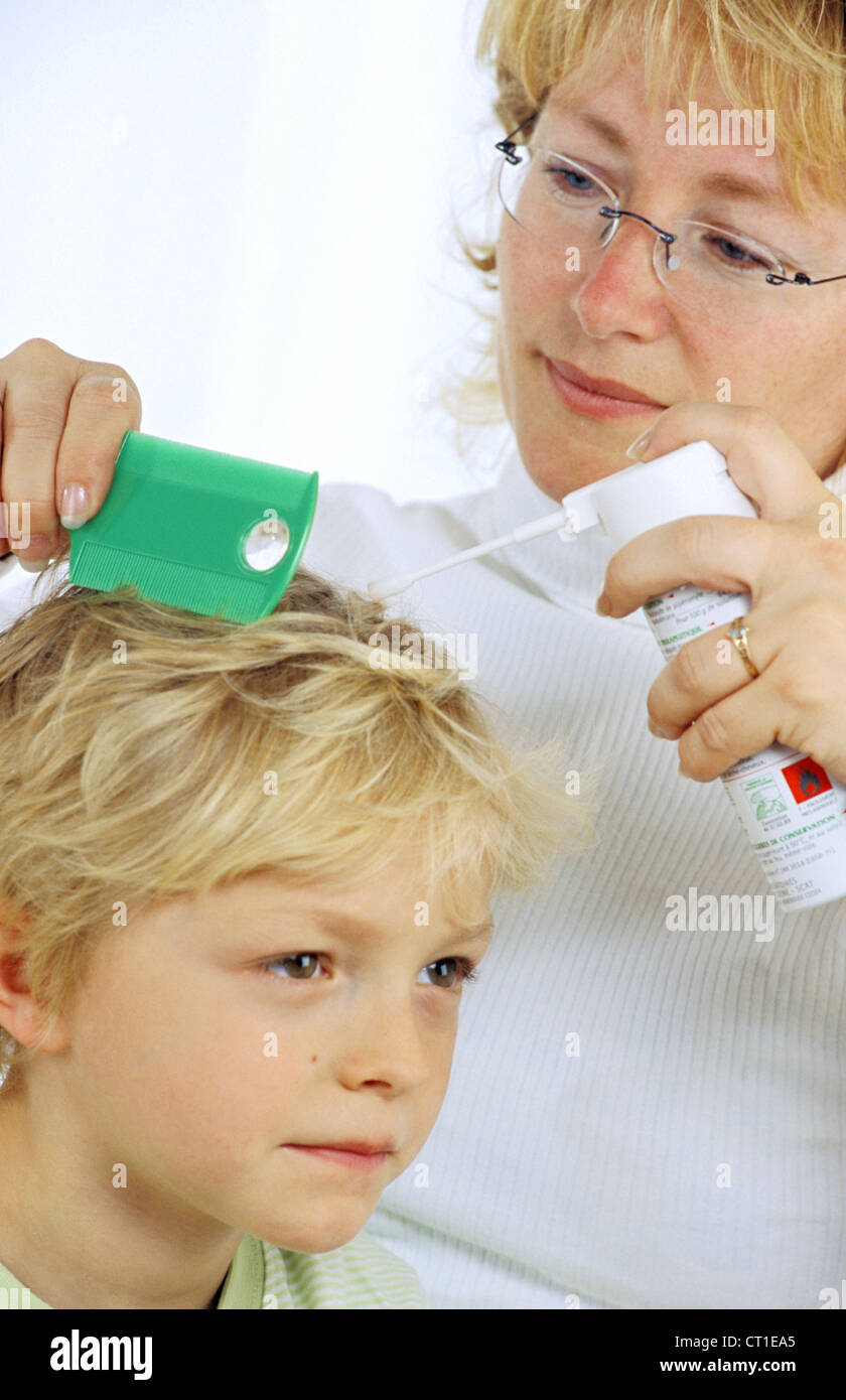 TREATMENT FOR LICE Stock Photo - Alamy